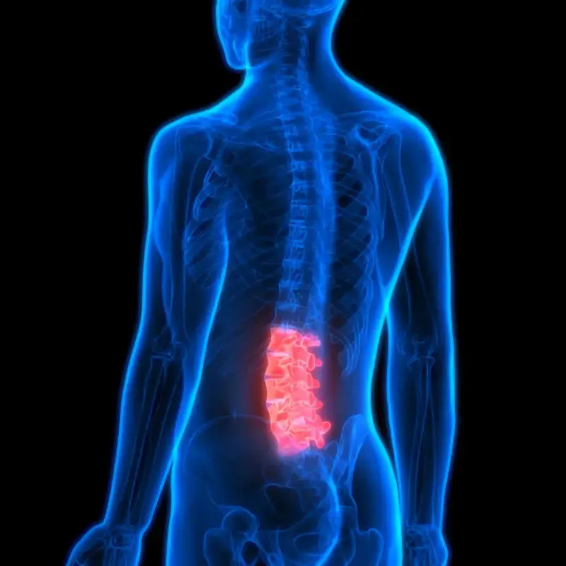 Back Pain: Causes & Treatment| Liebscher & Bracht