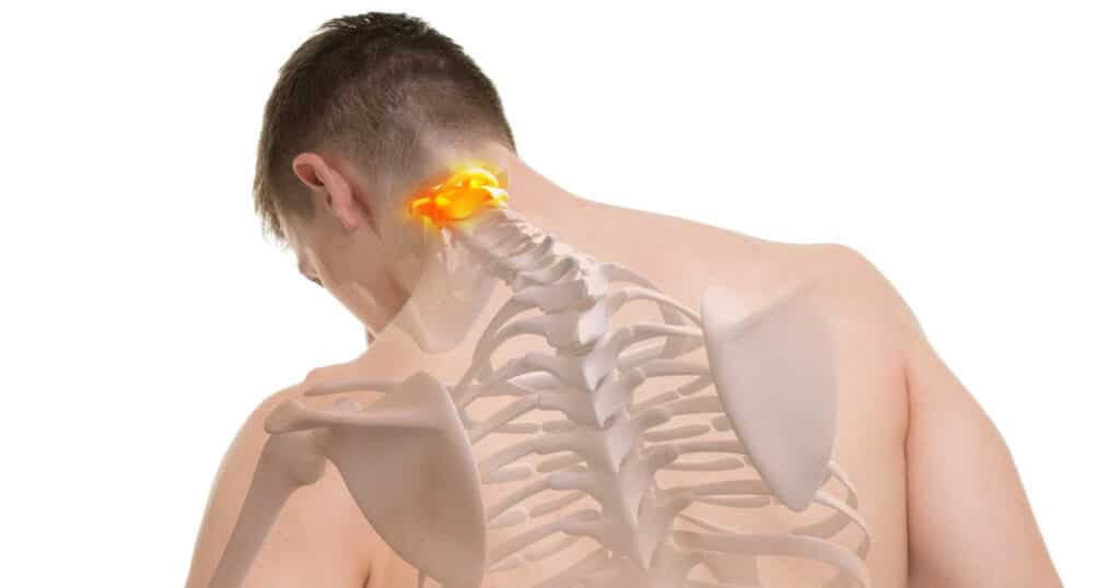 Atlas Correction Exercises for Neck Pain & Stiffness | Liebscher & Bracht