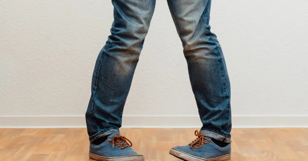 Genu Valgum: Knock Knees Exercises for Pain Relief | Liebscher & Bracht