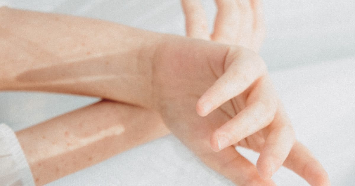 Wrist Tendonitis Treatment at Home | Liebscher & Bracht