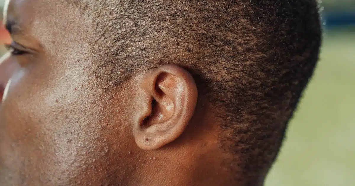 Somatic Tinnitus (Somatosensory Tinnitus) | What You Need to Know ...
