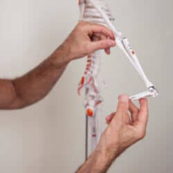 Schnappfinger: Ursachen & Übungen | Liebscher & Bracht