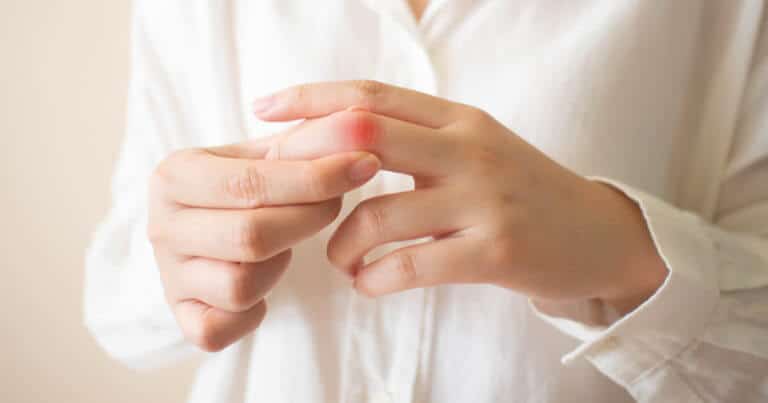 Arthrose im Finger: Endlich Schluss mit den Schmerzen | Liebscher & Bracht