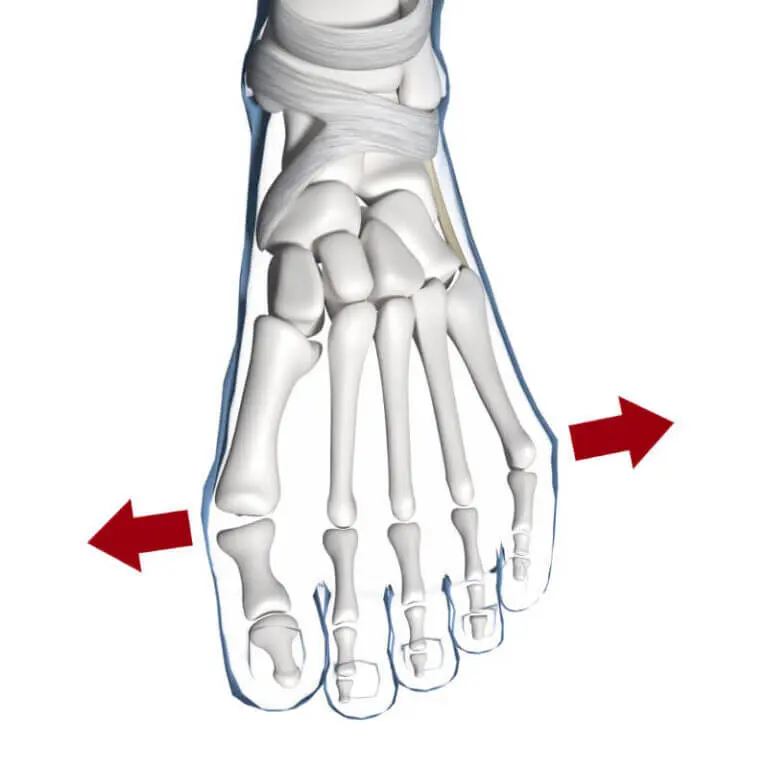 Spreizfuß: Alles zu Ursachen, Behandlung und Übungen | Liebscher & Bracht