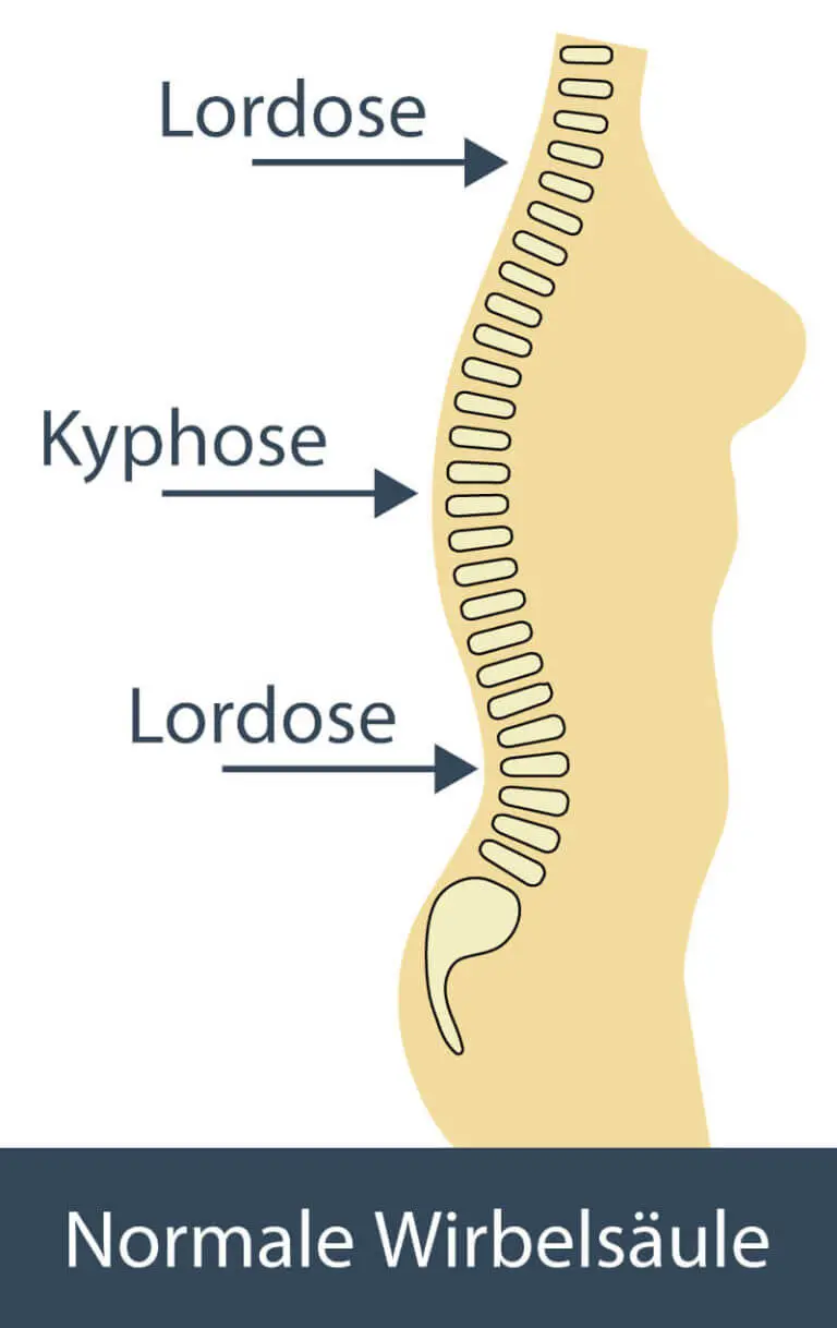 Hohlkreuz – Ursachen & Behandlung | Liebscher & Bracht