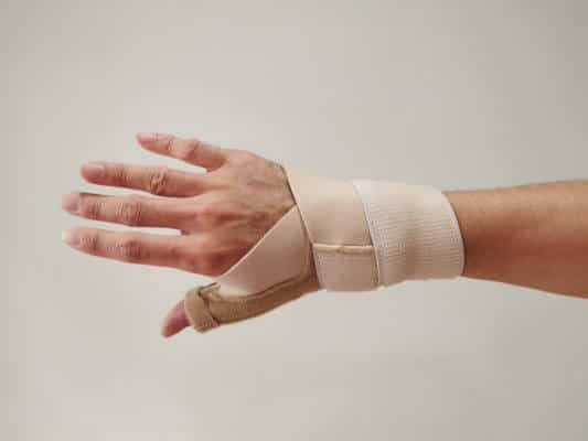 Rhizarthrose: Arthrose im Daumen – Ursache & Behandlung