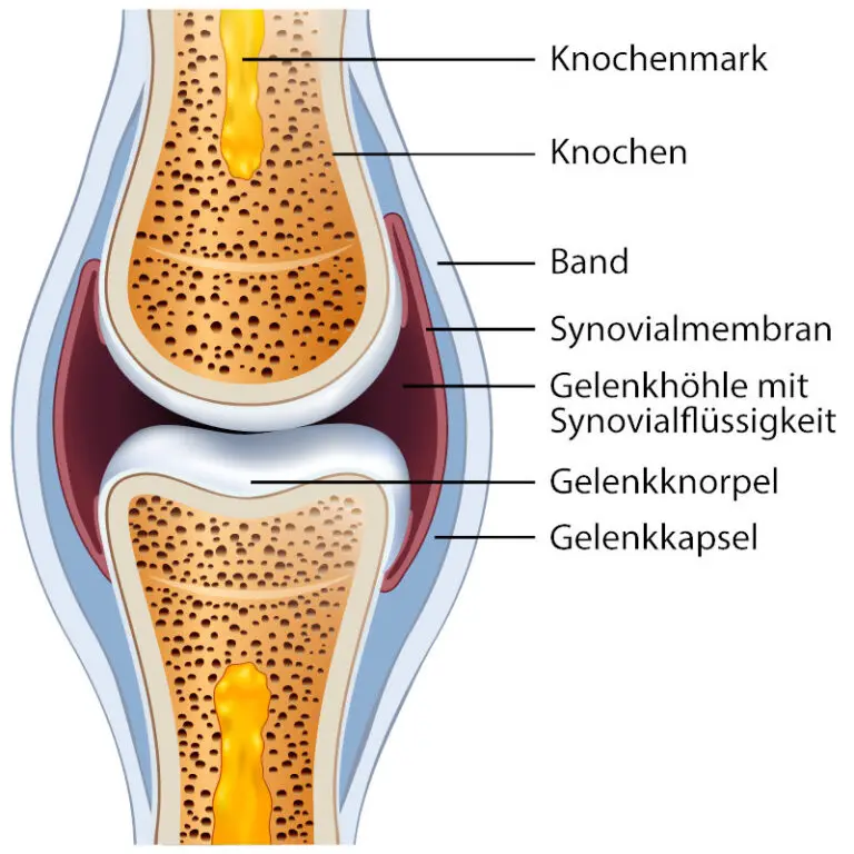 Spondylarthrose & Facettensyndrom stoppen | Liebscher & Bracht