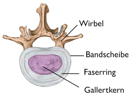 Bandscheibenprotrusion: Symptome & Behandlung | Liebscher & Bracht