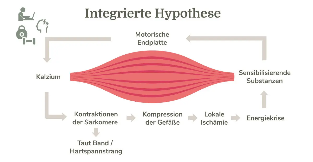 Triggerpunkte: Ursachen, Symptome & neue Behandlung | Liebscher & Bracht