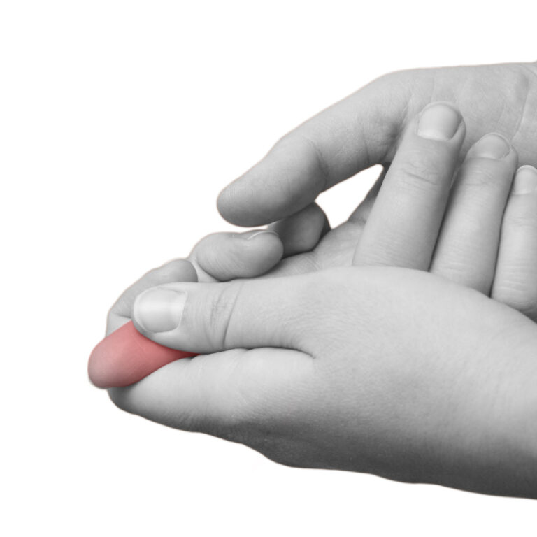 Arthrose im Finger: Endlich Schluss mit den Schmerzen | Liebscher & Bracht