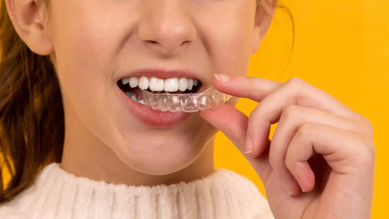 Knirschschiene: Welche hilft bei Zähneknirschen? | Liebscher & Bracht