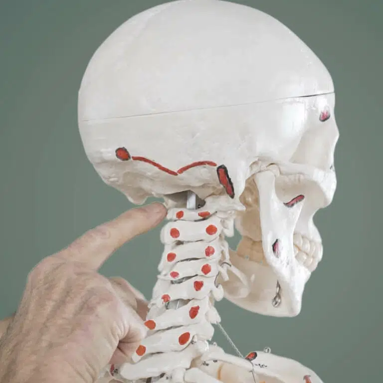 Atlas-Fehlstellung einfach erklärt | Liebscher & Bracht