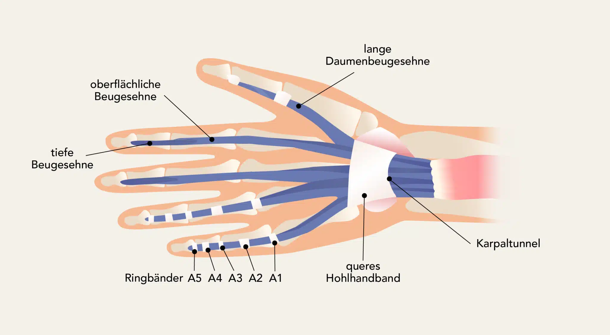 Schnappfinger – Ursache, Sympthome & Behandlung